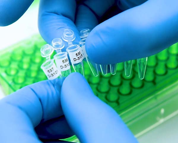 Lab Sample Management: Data Integrity and Success | BRADY